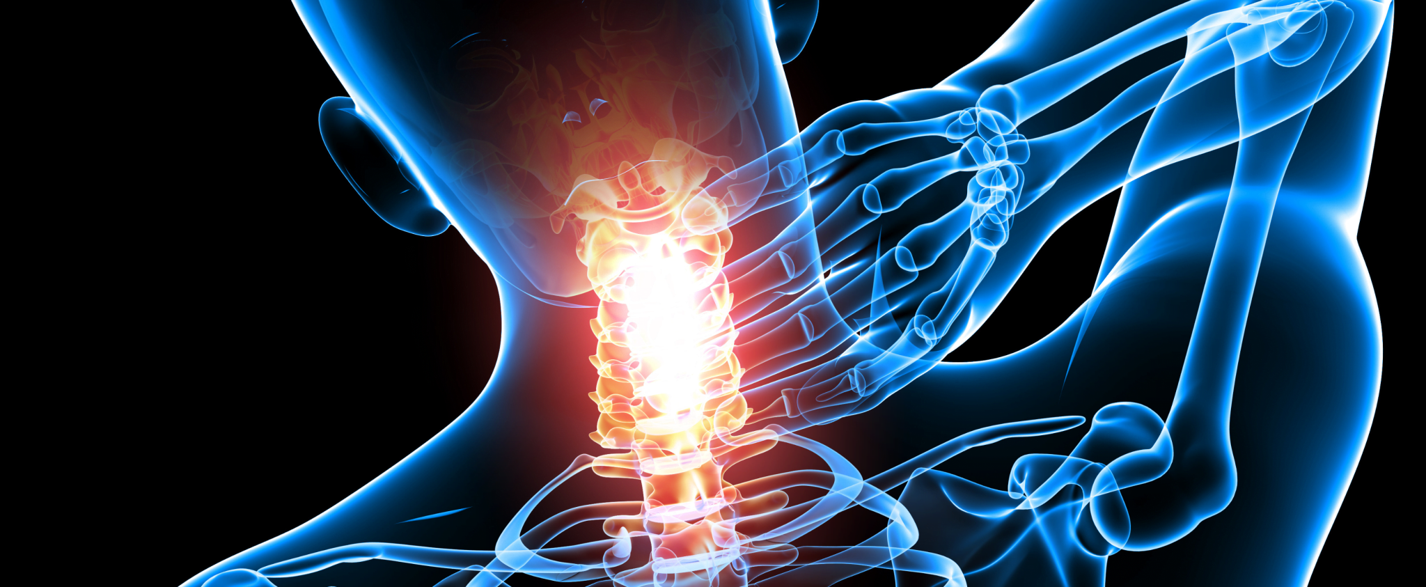 Understanding the Whiplash-Associated Disorder (WAD) Classification ...